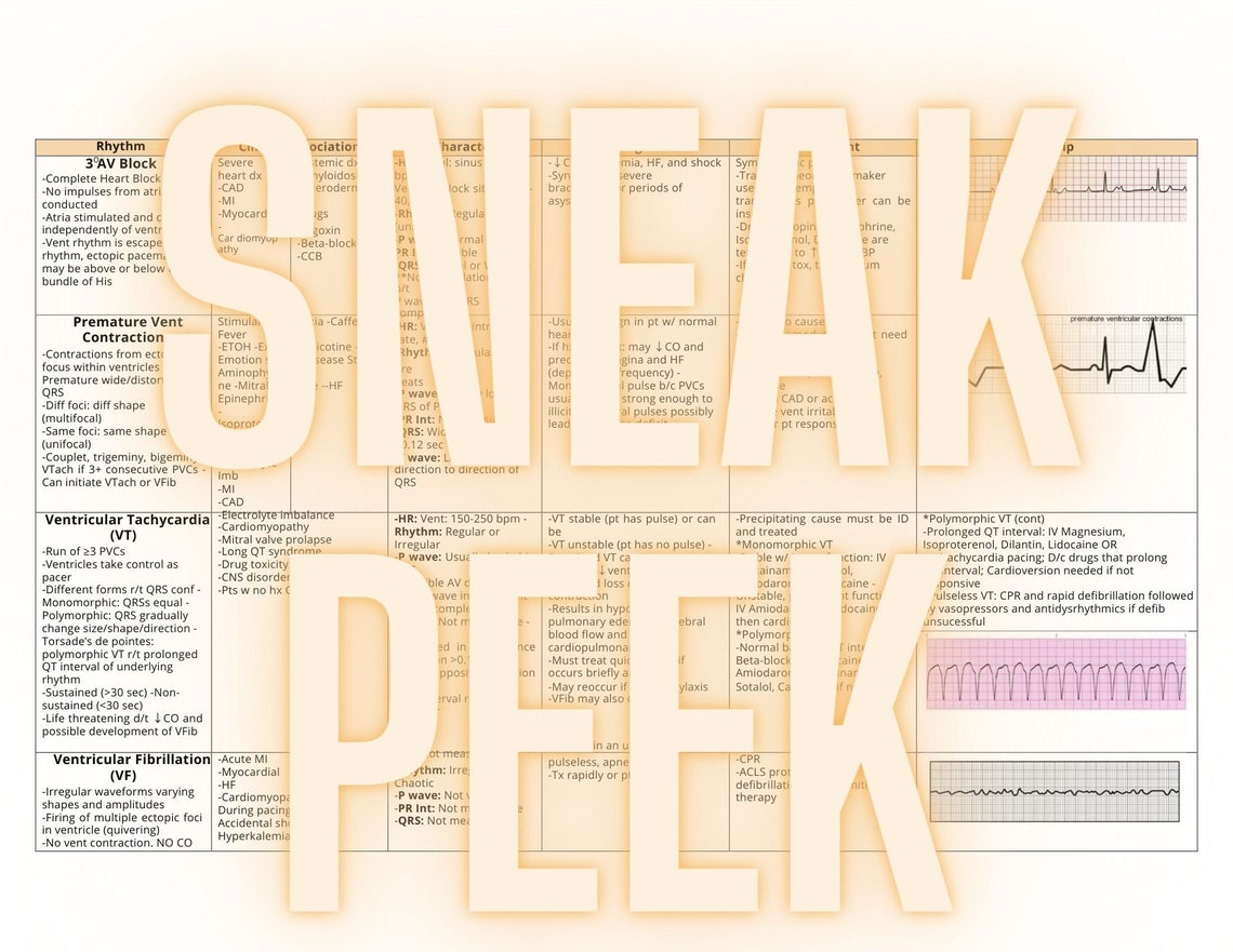 EKG Basics Printable Chart PDF - Etsy