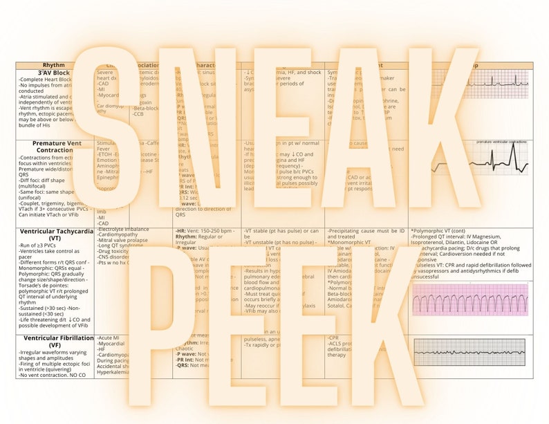 EKG Basics Printable Chart PDF - Etsy