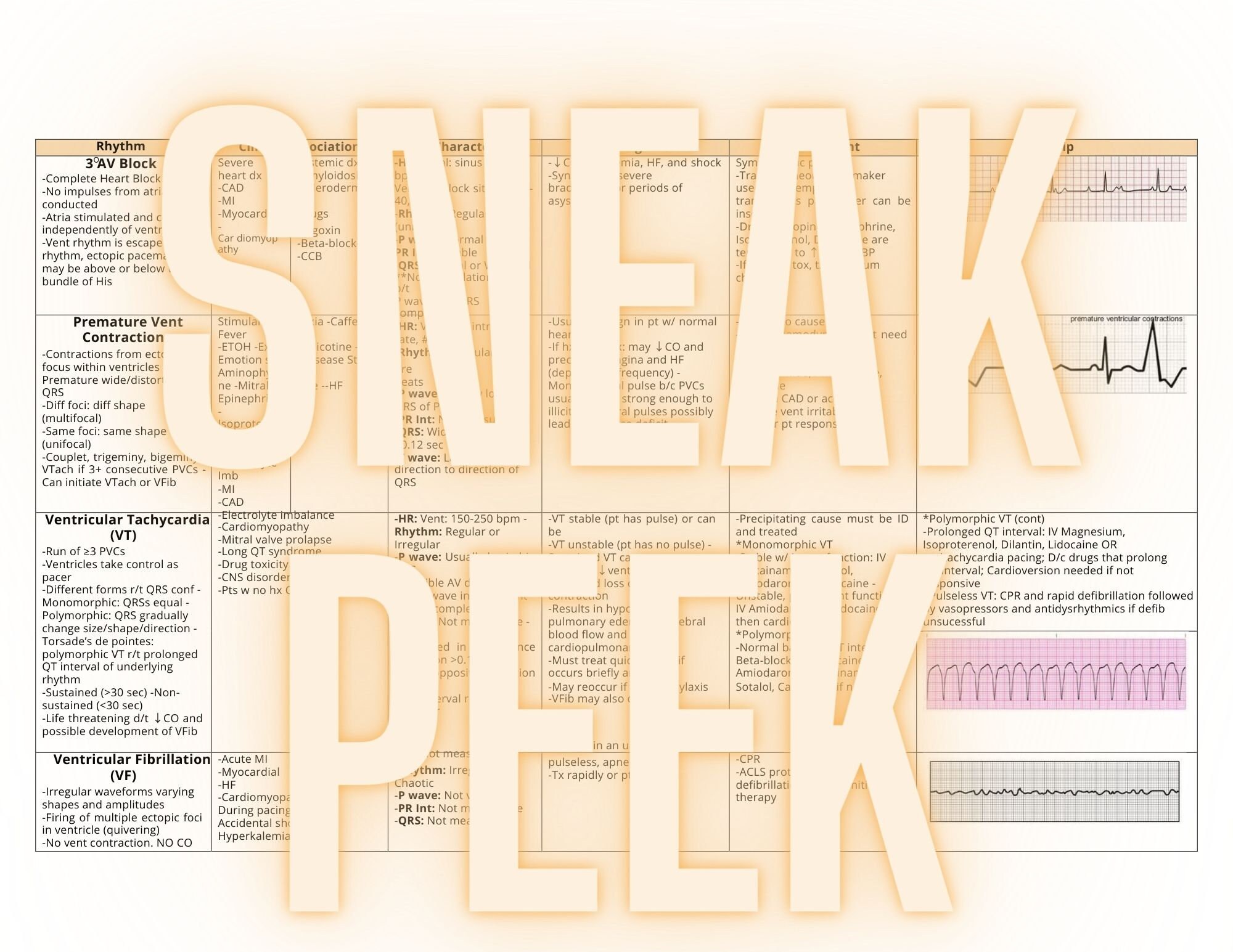 EKG Basics Printable Chart PDF - Etsy