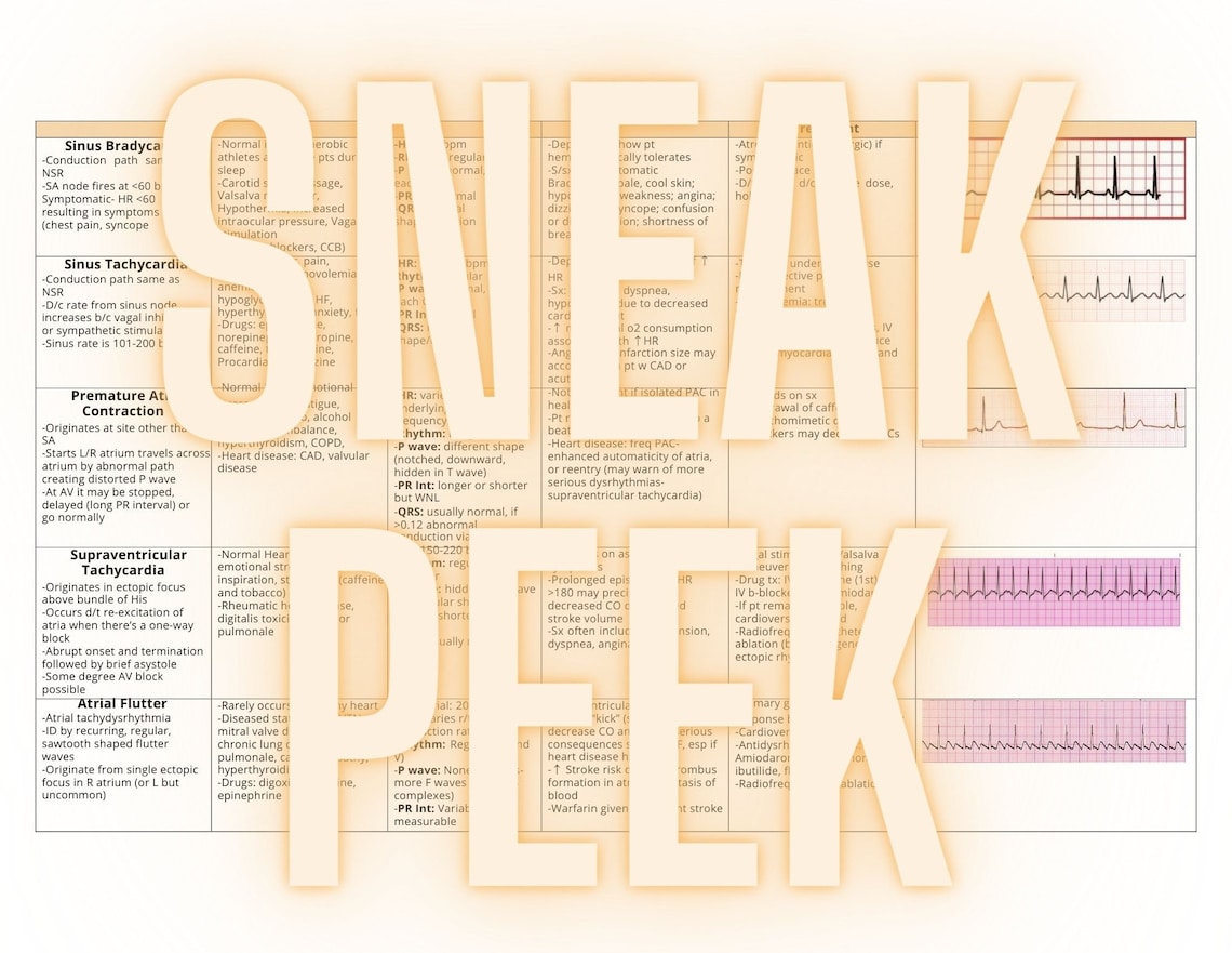 EKG Basics Printable Chart PDF - Etsy