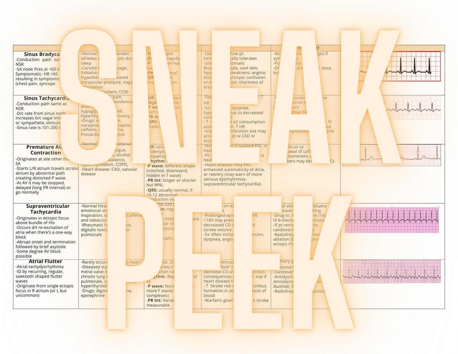 EKG Basics Printable Chart PDF - Etsy