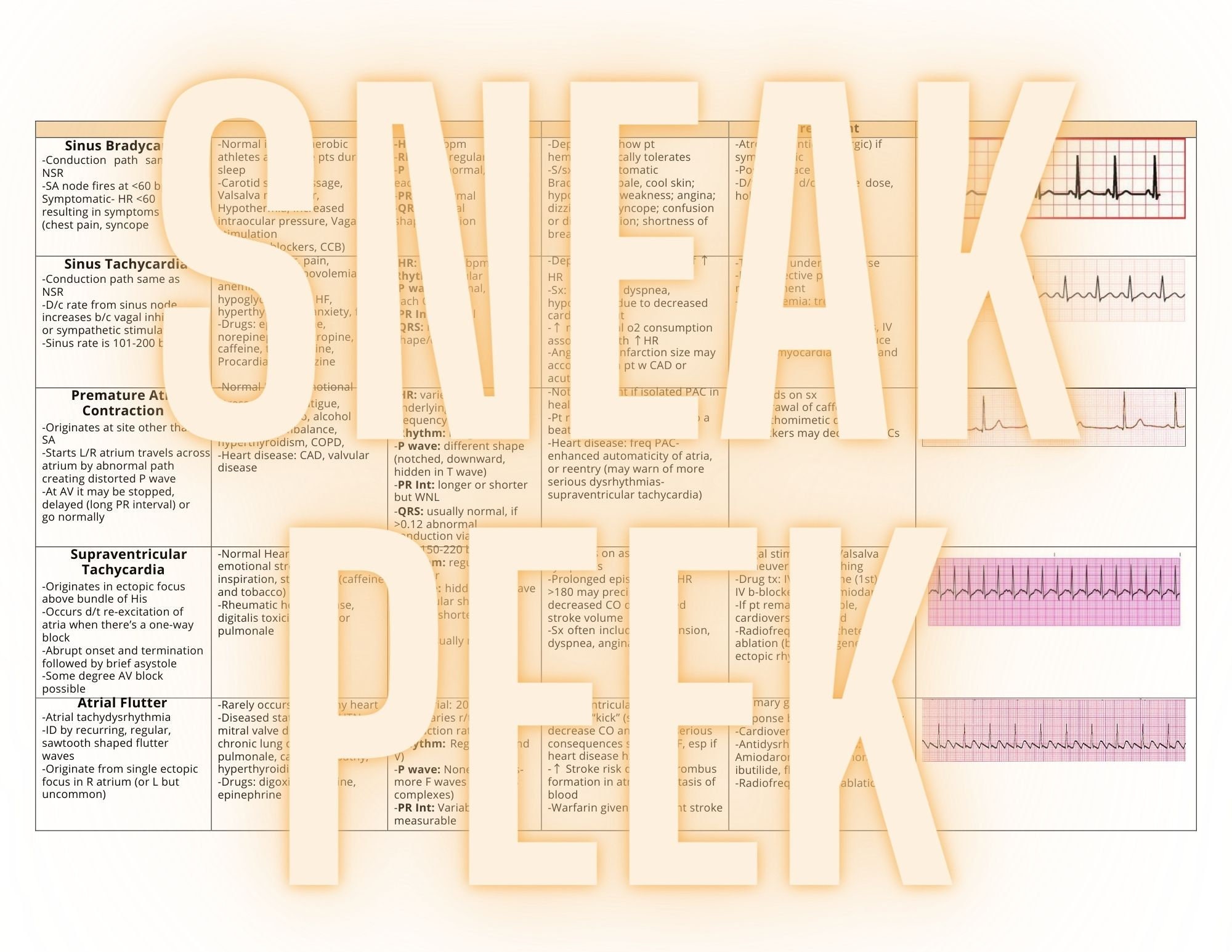 EKG Basics Printable Chart PDF - Etsy