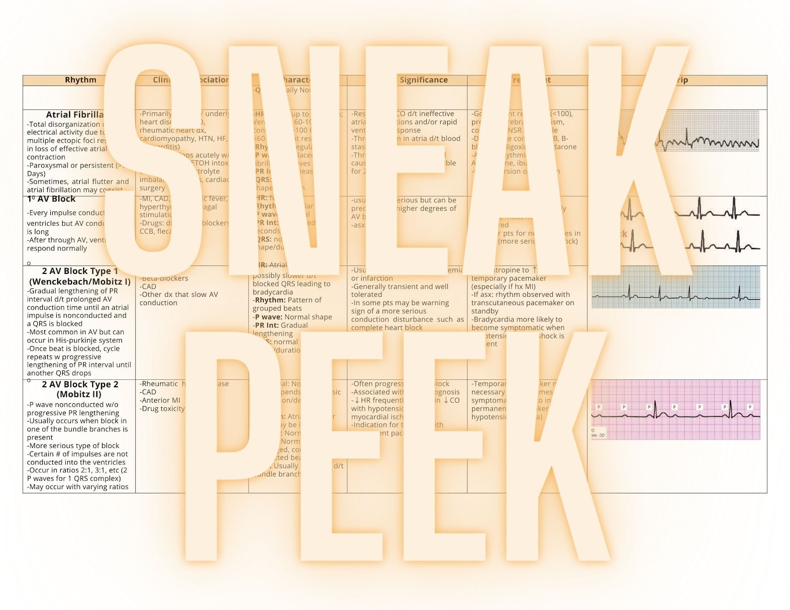EKG Basics Printable Chart PDF - Etsy