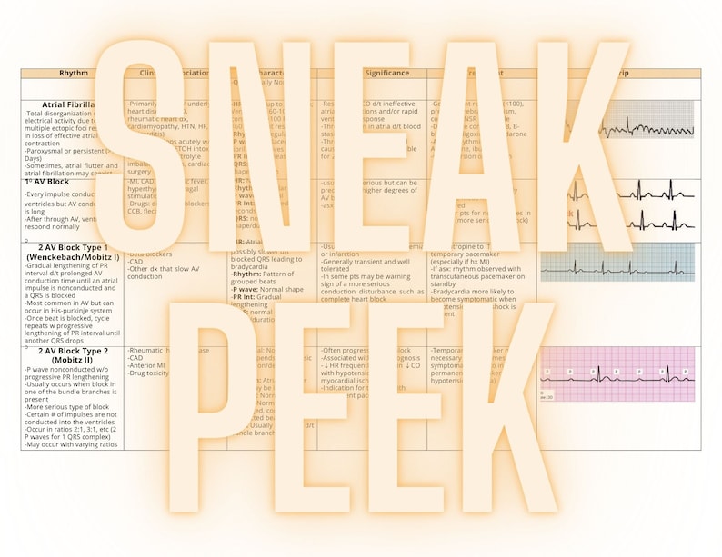 EKG Basics Printable Chart PDF - Etsy