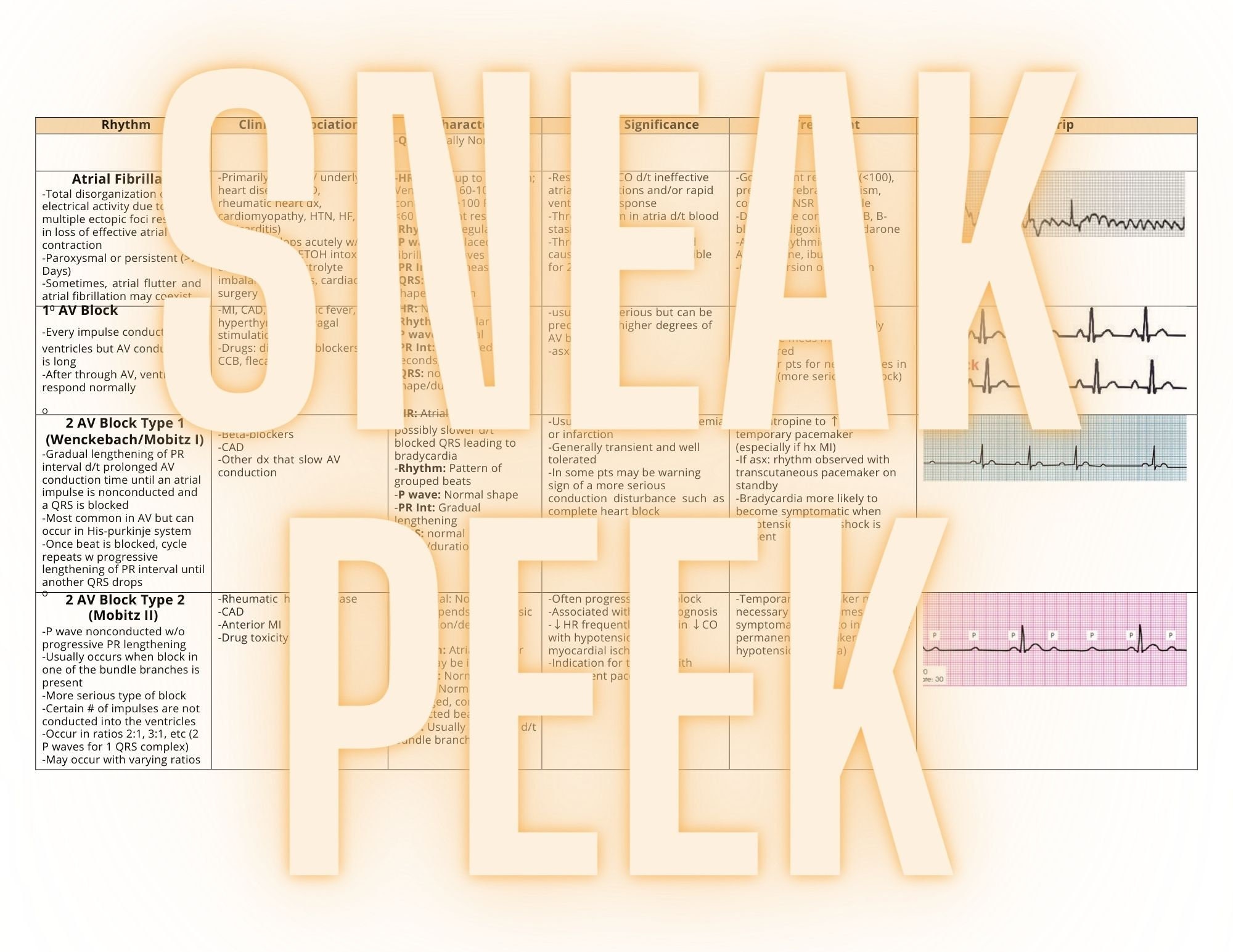 EKG Basics Printable Chart PDF - Etsy