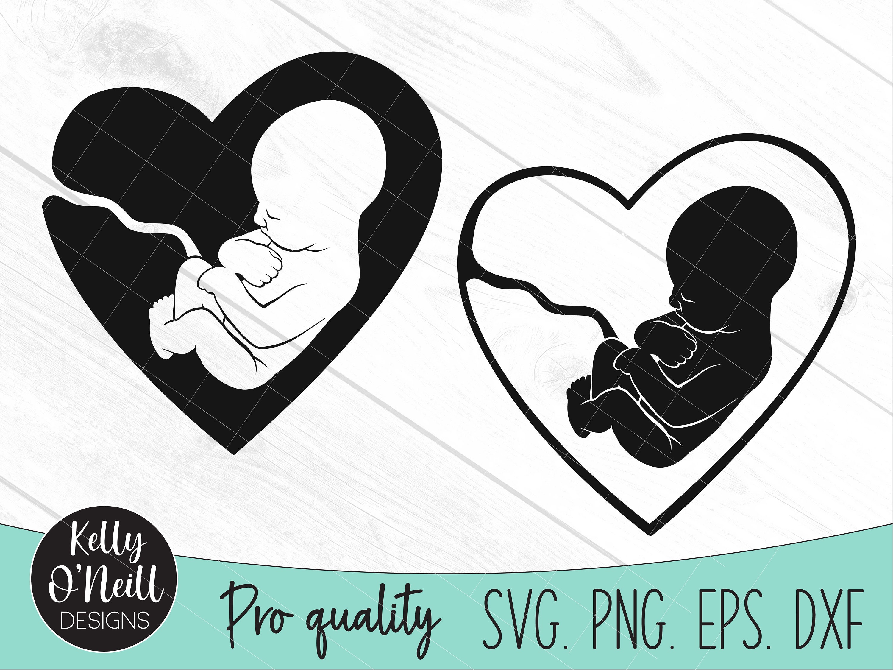 Baby in Womb Clipart, Baby in Womb SVG, Fetus in Womb, Pro Life SVG ...
