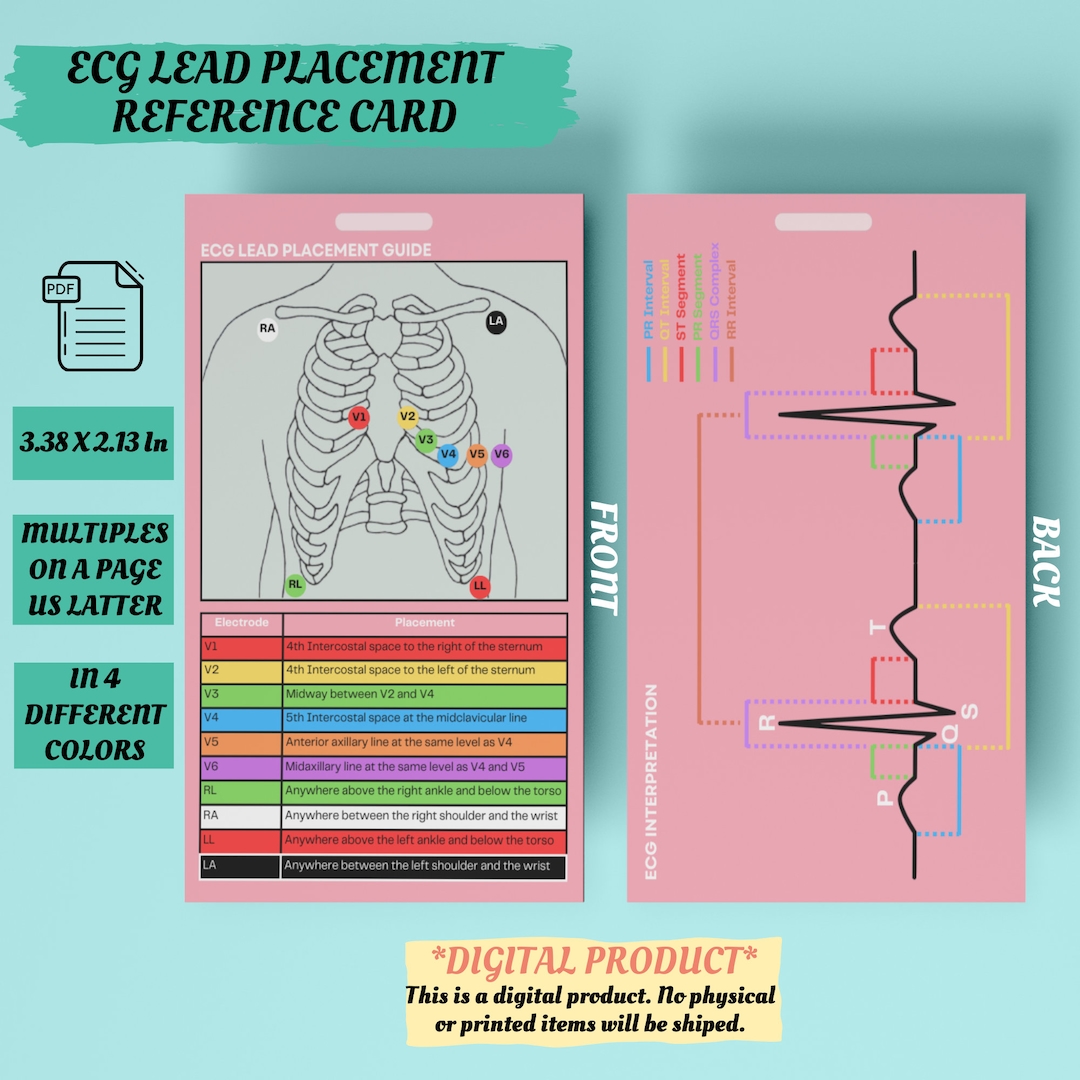 ECG Lead Placement Reference Card ECG Interpretation Guide - Etsy UK
