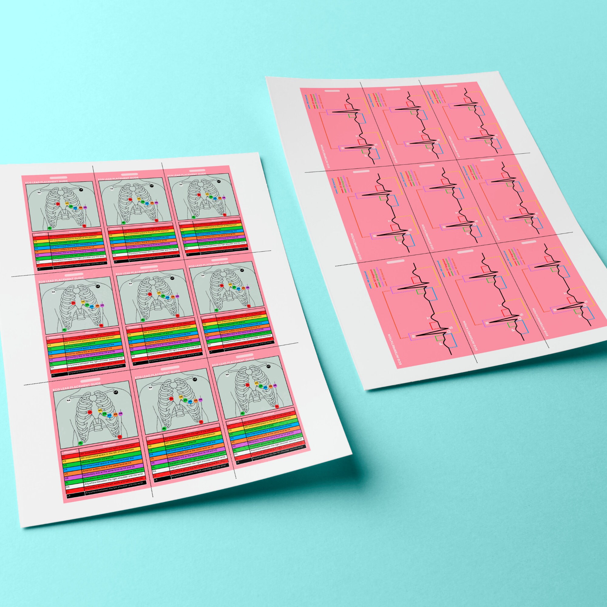 ECG Lead Placement Reference Card | ECG Interpretation Guide | Medical ...