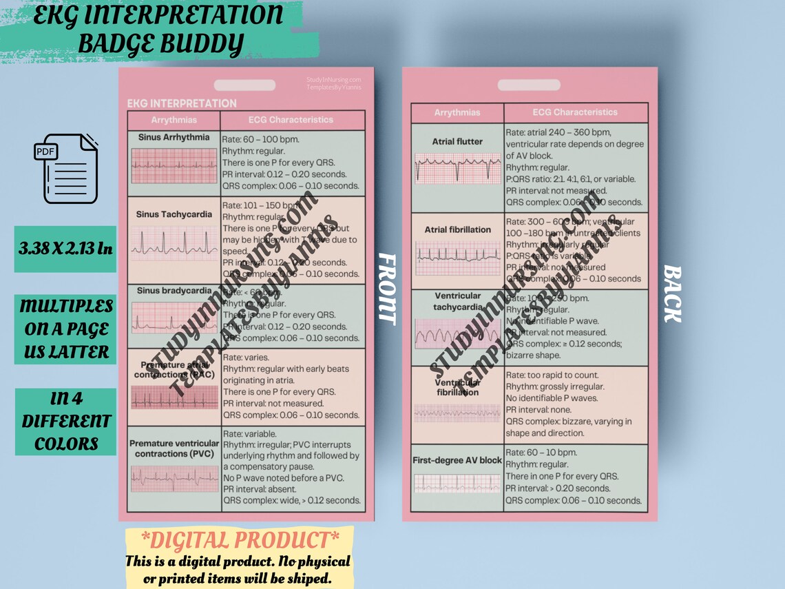 EKG & Dysrhythmia Interpretation Quick Reference Card | ECG Guide ...