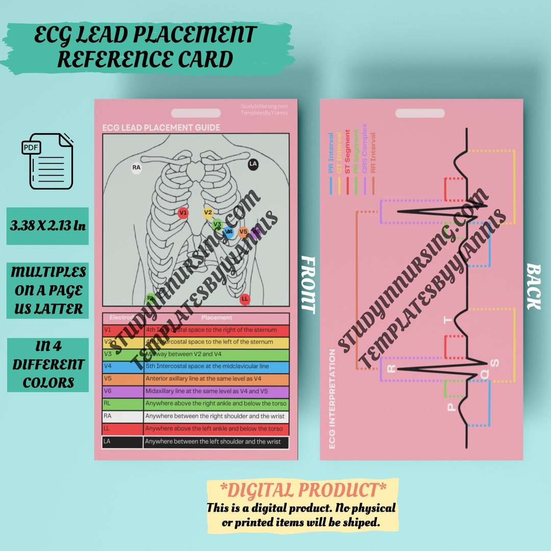 ECG Lead Placement Reference Card | ECG Interpretation Guide | Medical ...