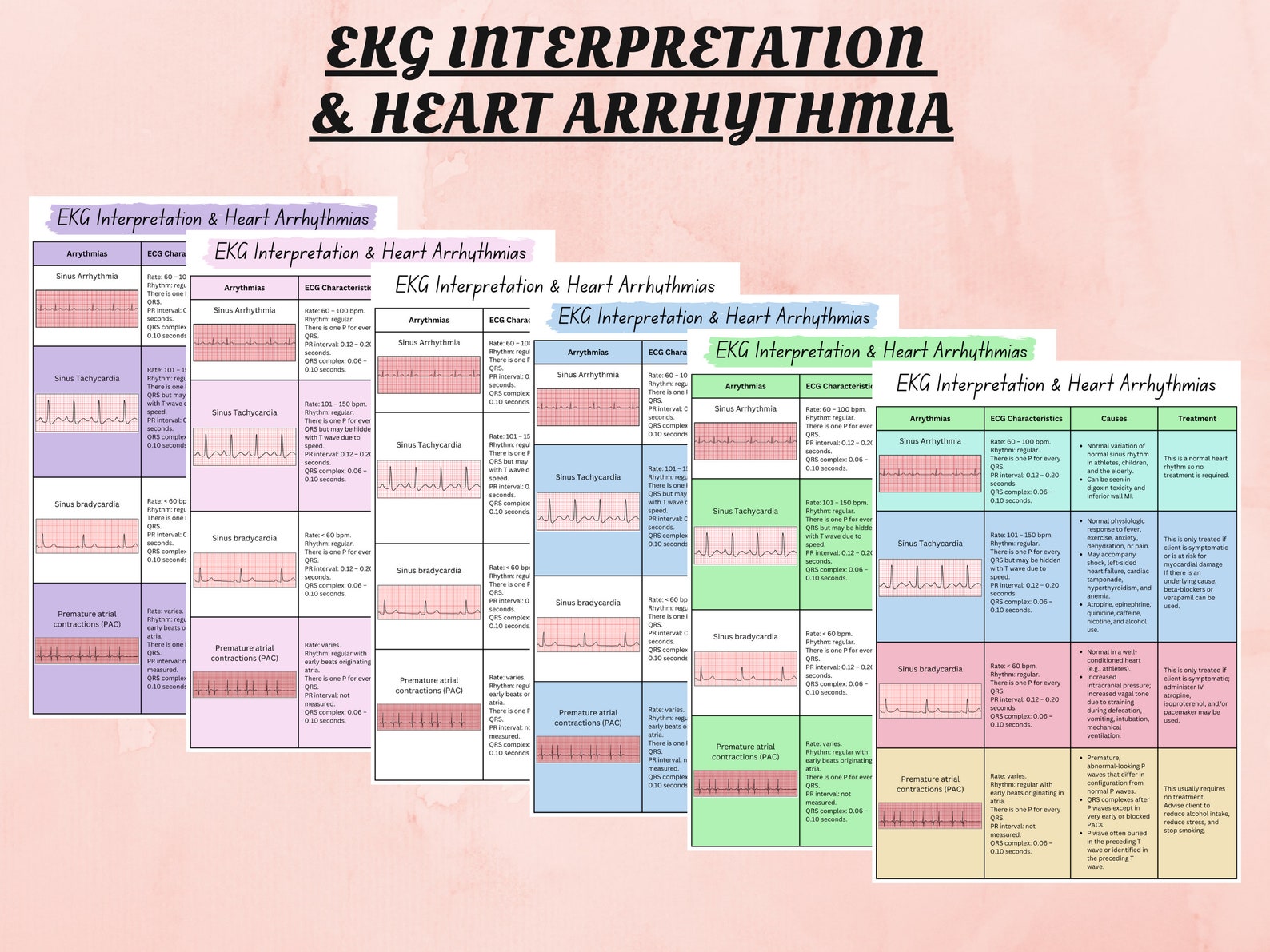 EKG & Dysrhythmia Interpretation | Cardiac Rhythm | Nursing School ...