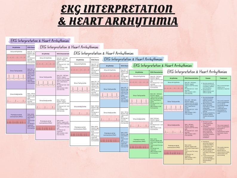 EKG and Dysrhythmia Interpretation Guide: Cardiac Rhythm Nursing School ...