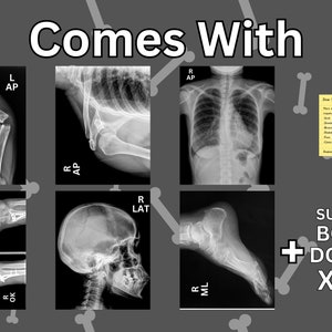 Play X-rays Best Quality Pretend Radiographs for Kids Doctor ...