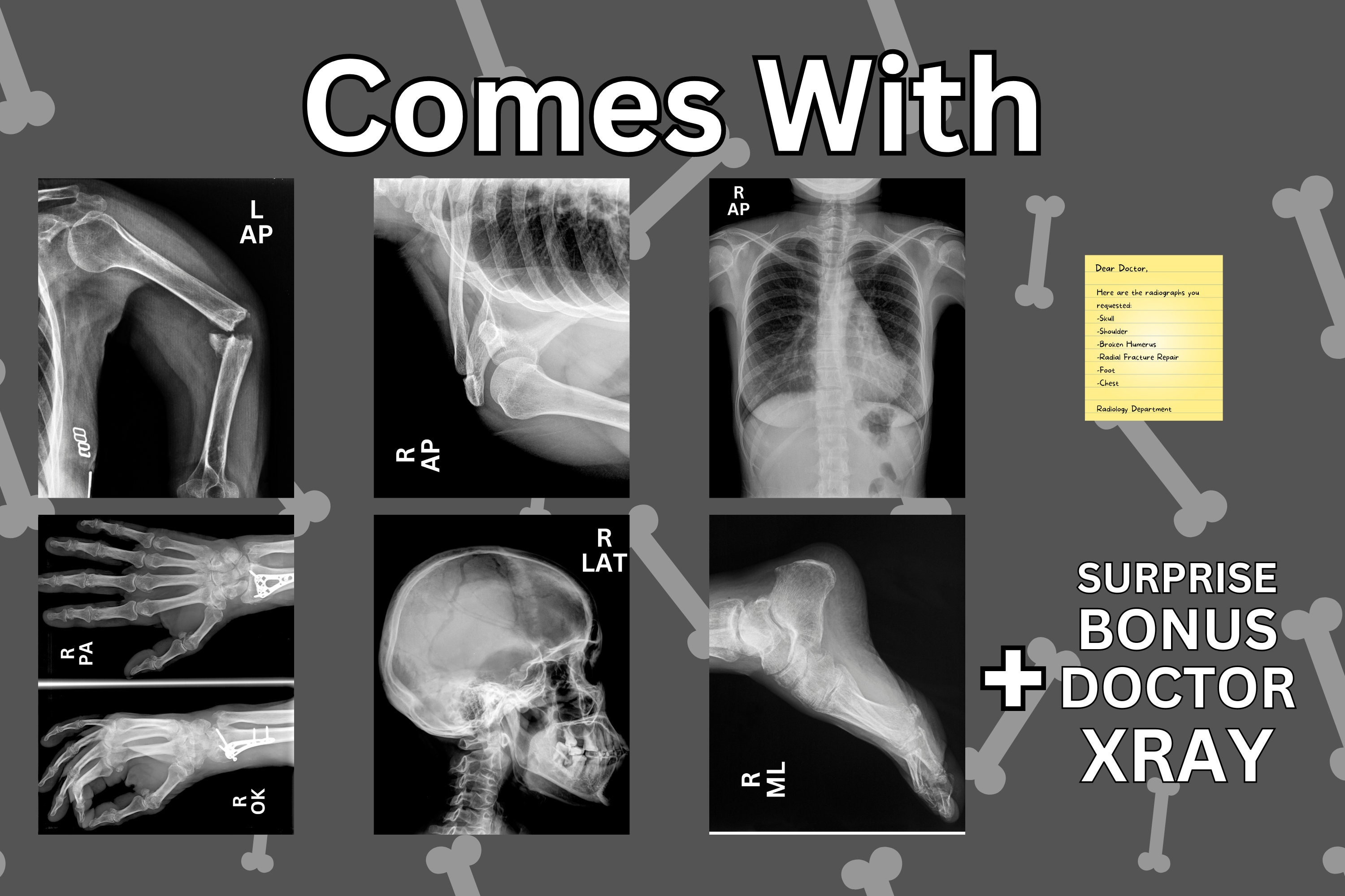 Play X-rays Best Quality Pretend Radiographs for Kids Doctor ...