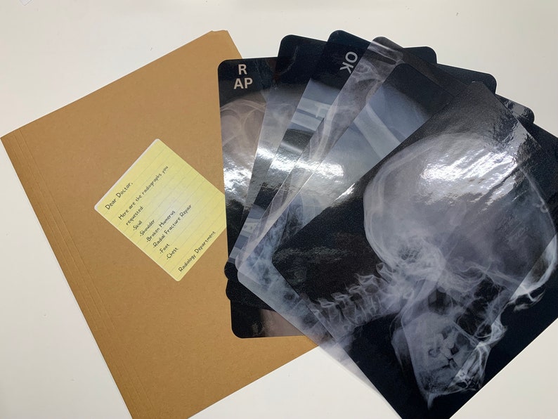 Play X-rays Best Quality Pretend Radiographs for Kids Doctor ...