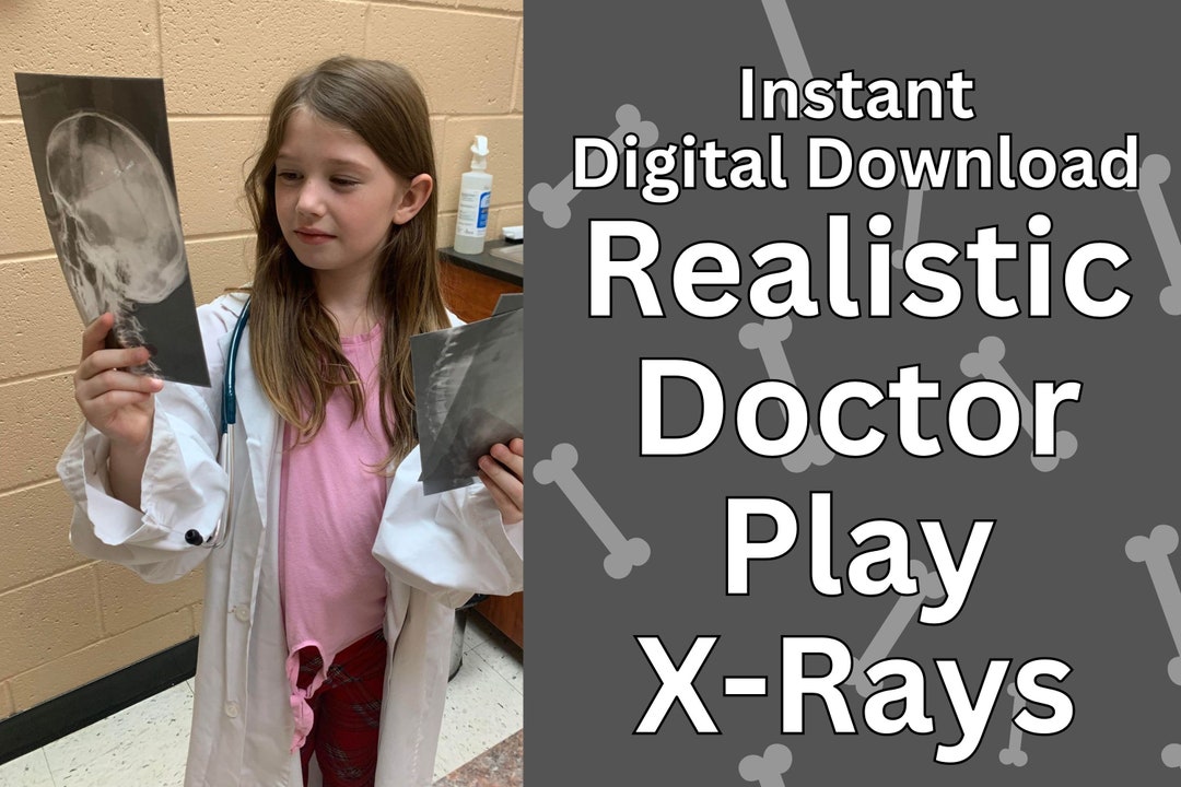 Play X-rays Best Quality Pretend Radiographs for Kids Doctor ...