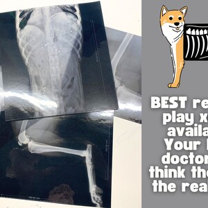 Physical Play X-rays Best Quality Pretend Radiographs for Kids Doctor ...