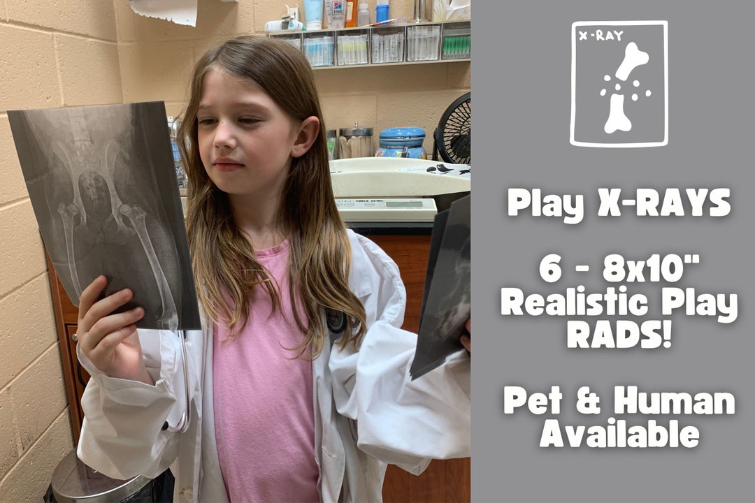 Physical Play X-rays Best Quality Pretend Radiographs for Kids Doctor ...