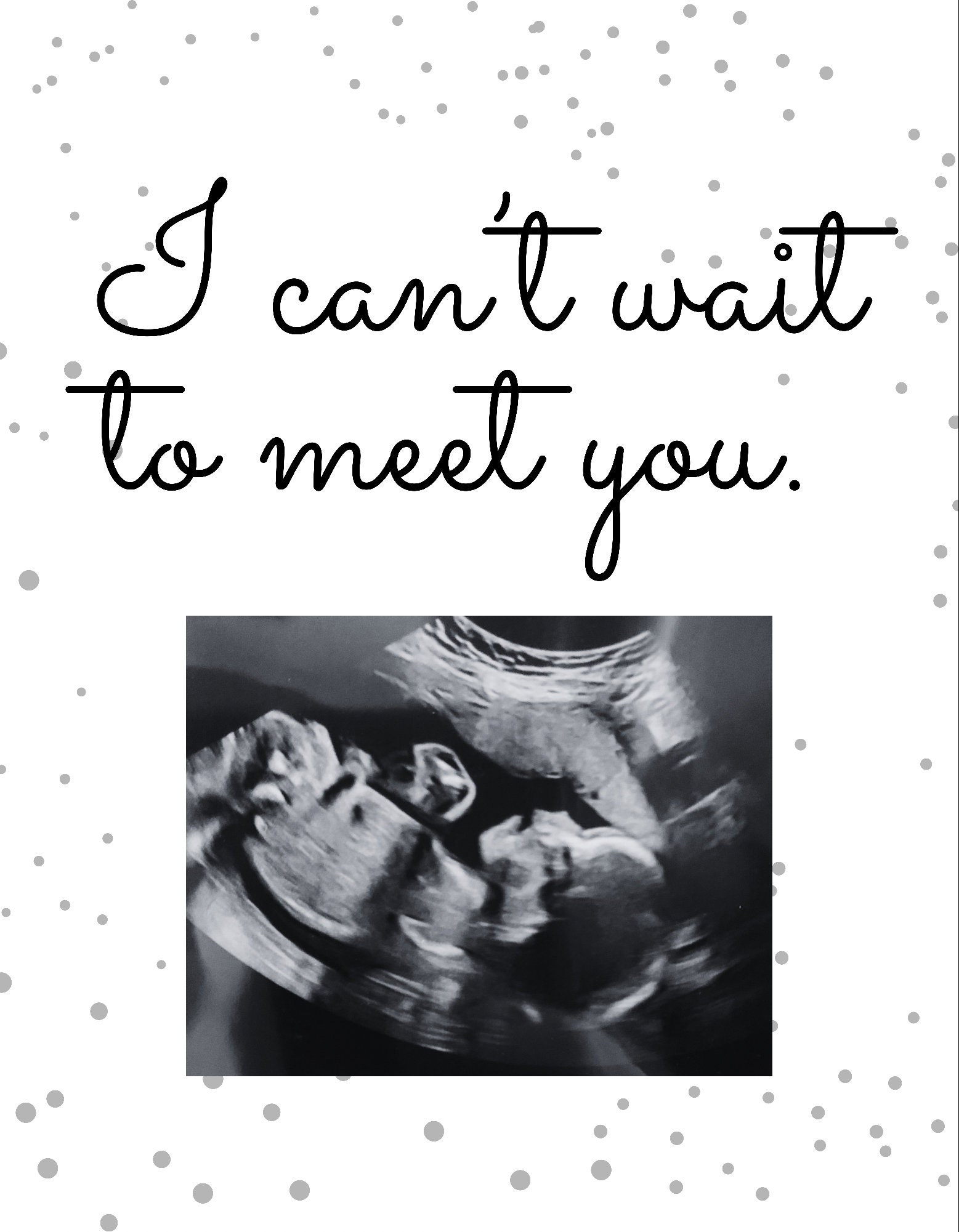 Cant Wait To See You Quotes