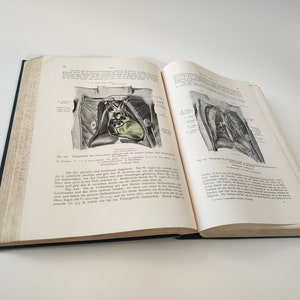 1915s SUPER RARE BOOK Medical Book / Very Very Old Antique Book. It is ...