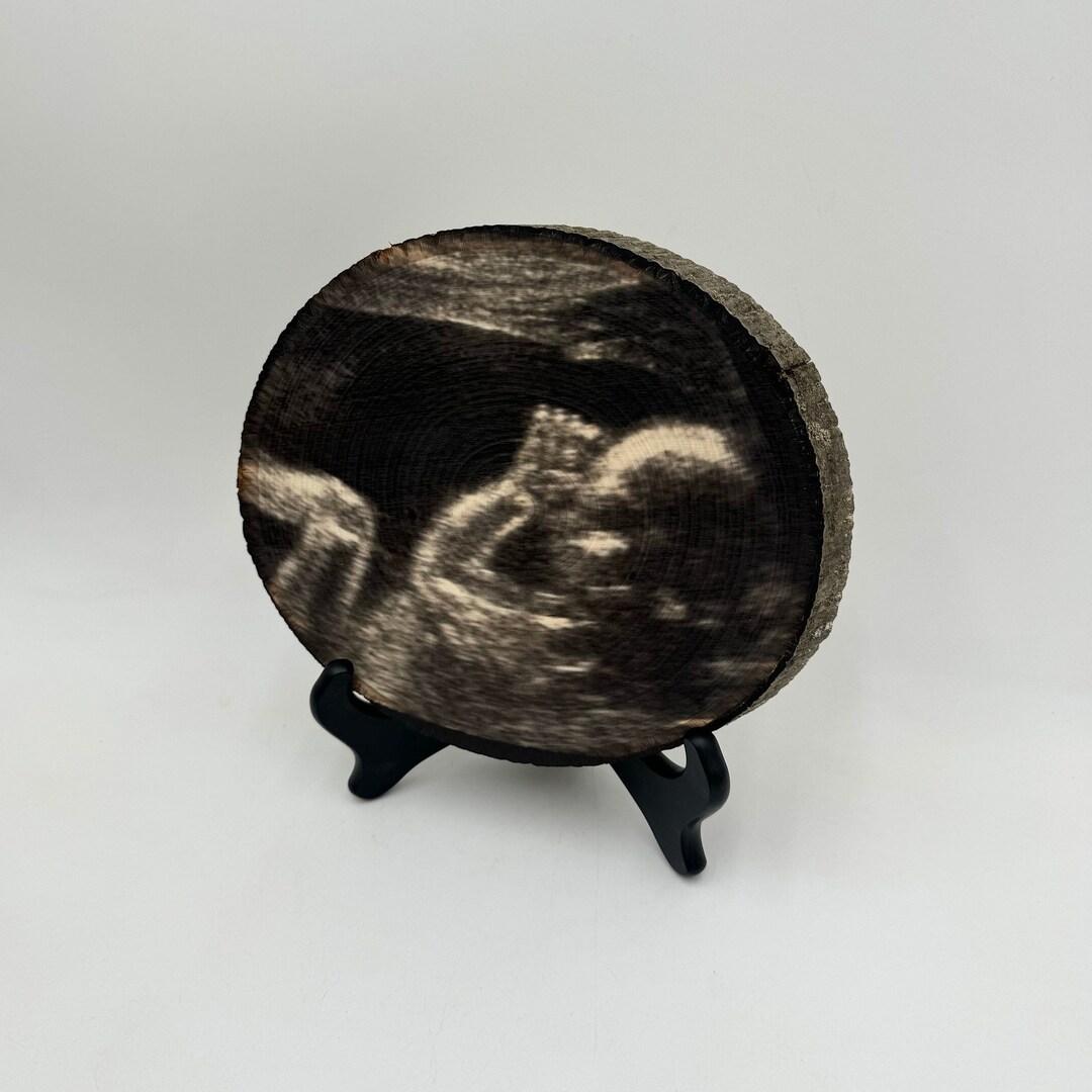 Ultrasound Photo Pregnancy Announcement Baby Shower Gift Expecting Mom ...