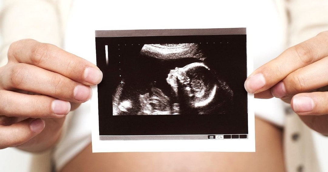 Baby Scan Photo Copies, Ultrasound Sonogram Duplicate Prints - Etsy