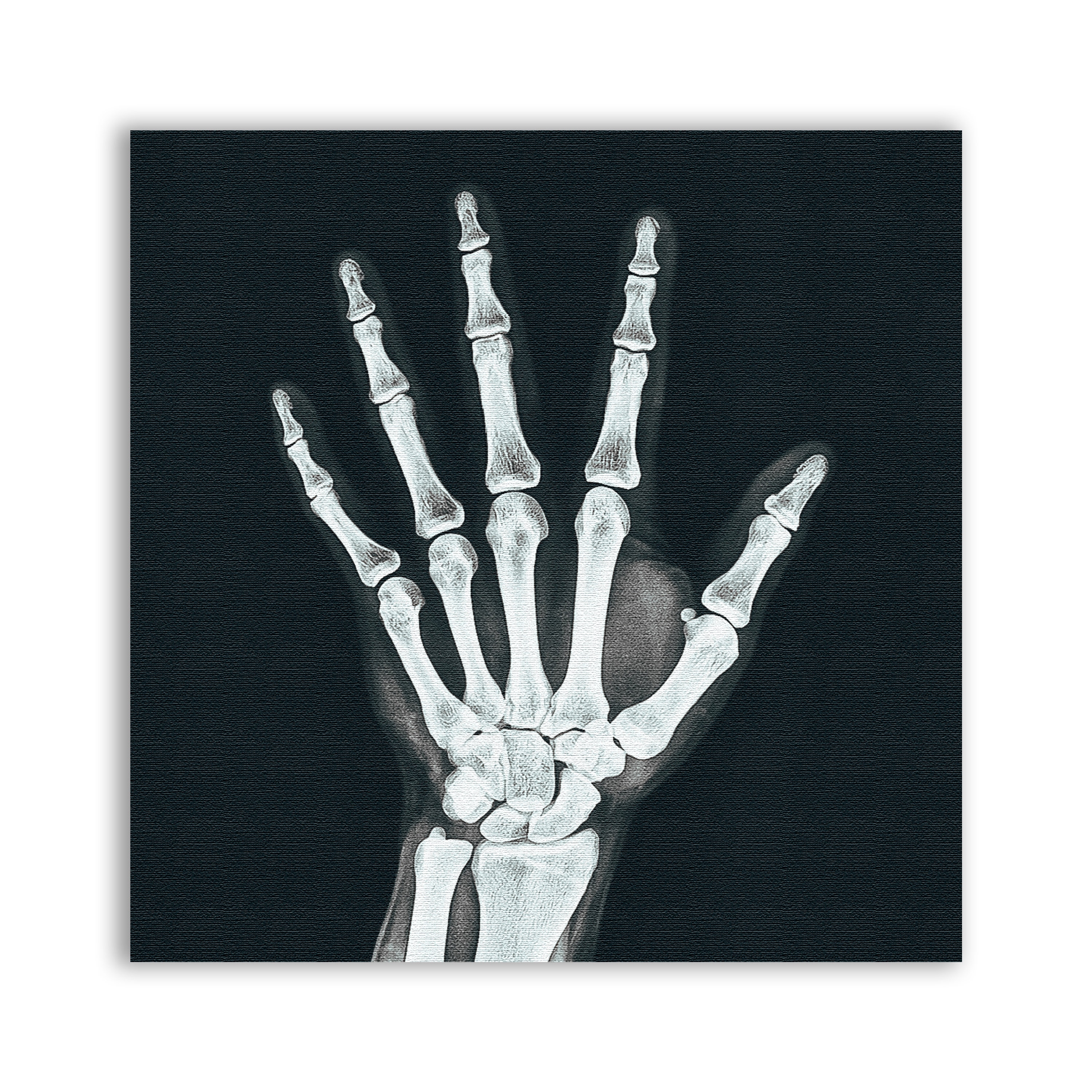 X Ray Hand Drawing