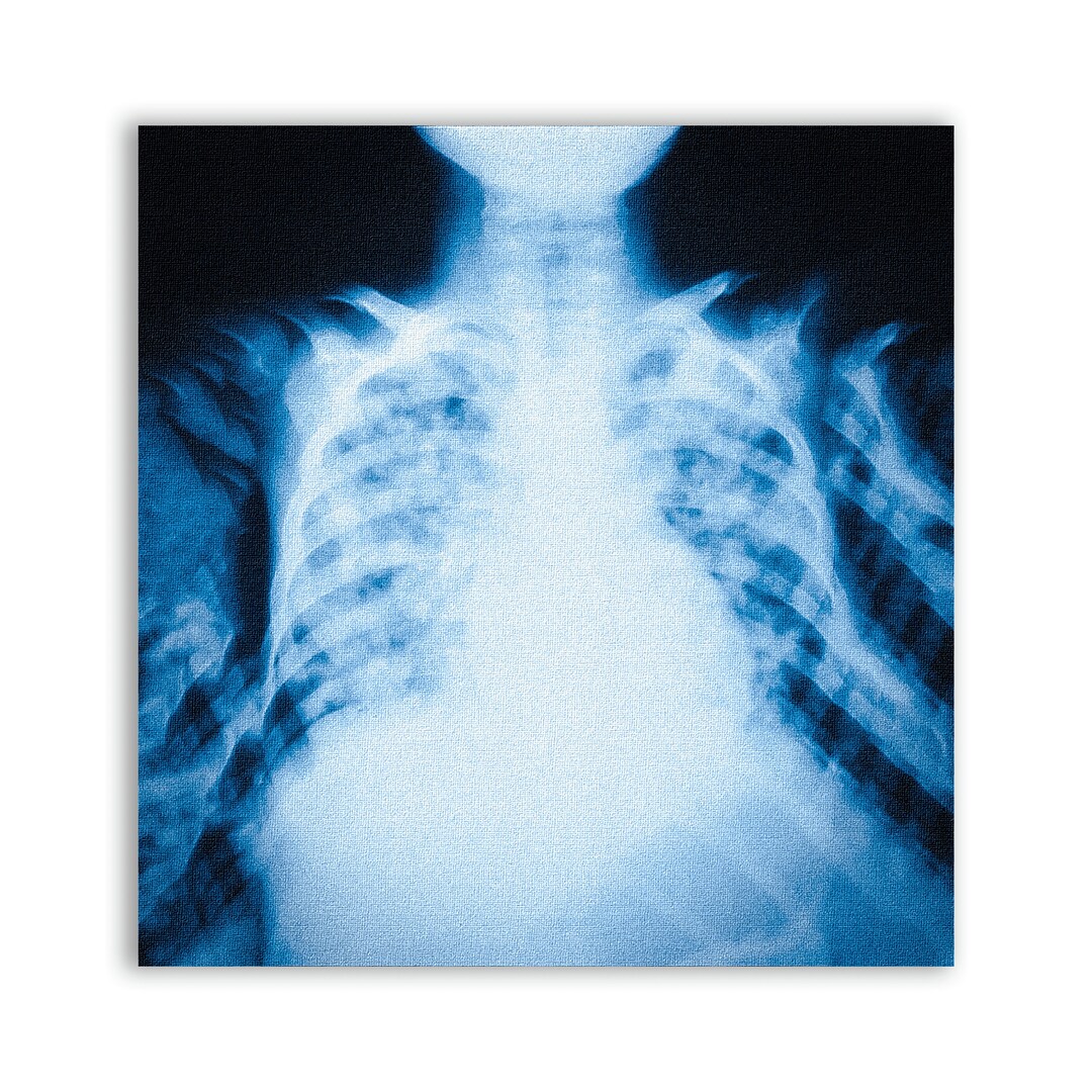 X-ray Rib Cage Patch - Etsy