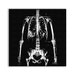 X-ray Body Patch - Etsy