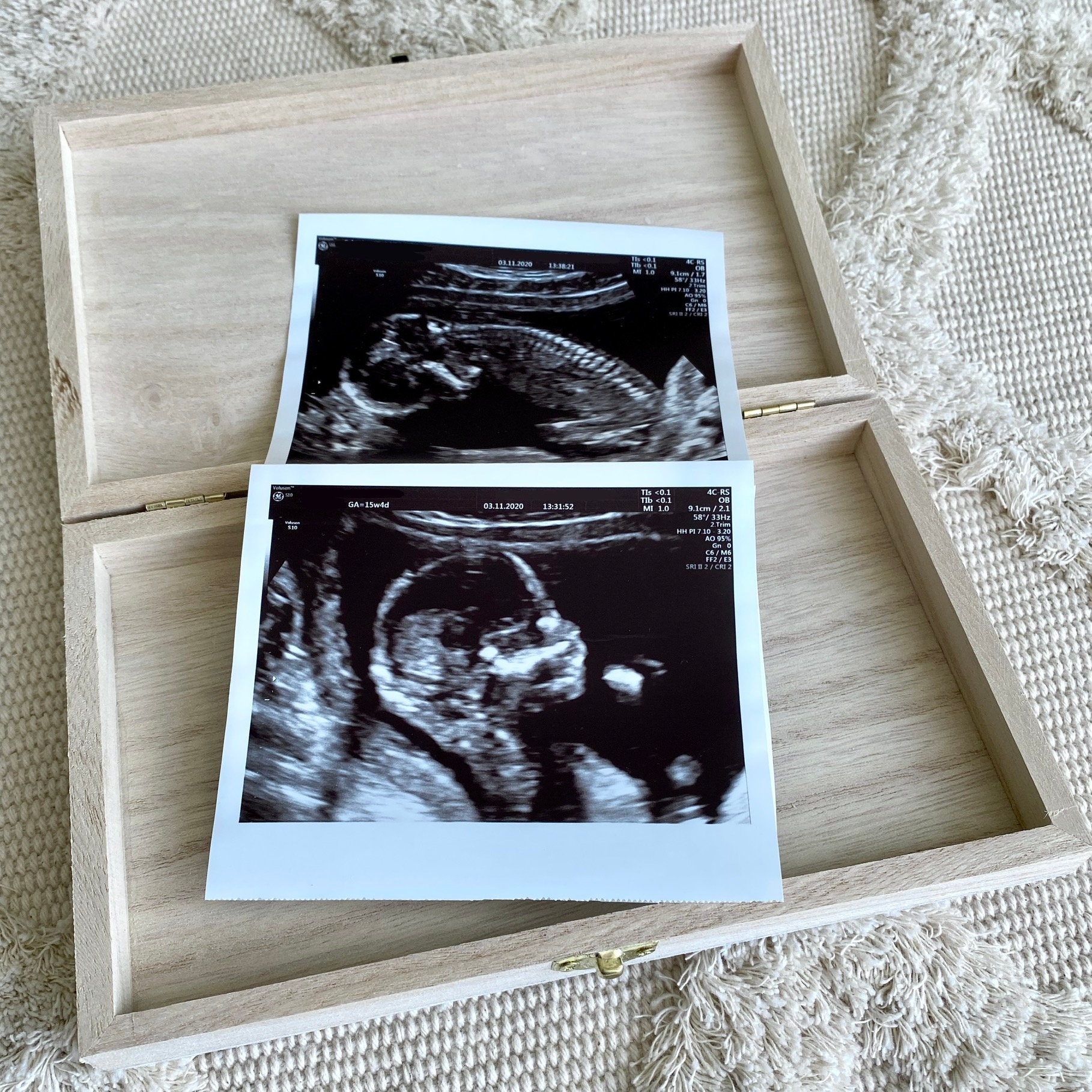 My Most Beautiful Ultrasounds Storage Box, Memory Box, Ultrasound Photo ...
