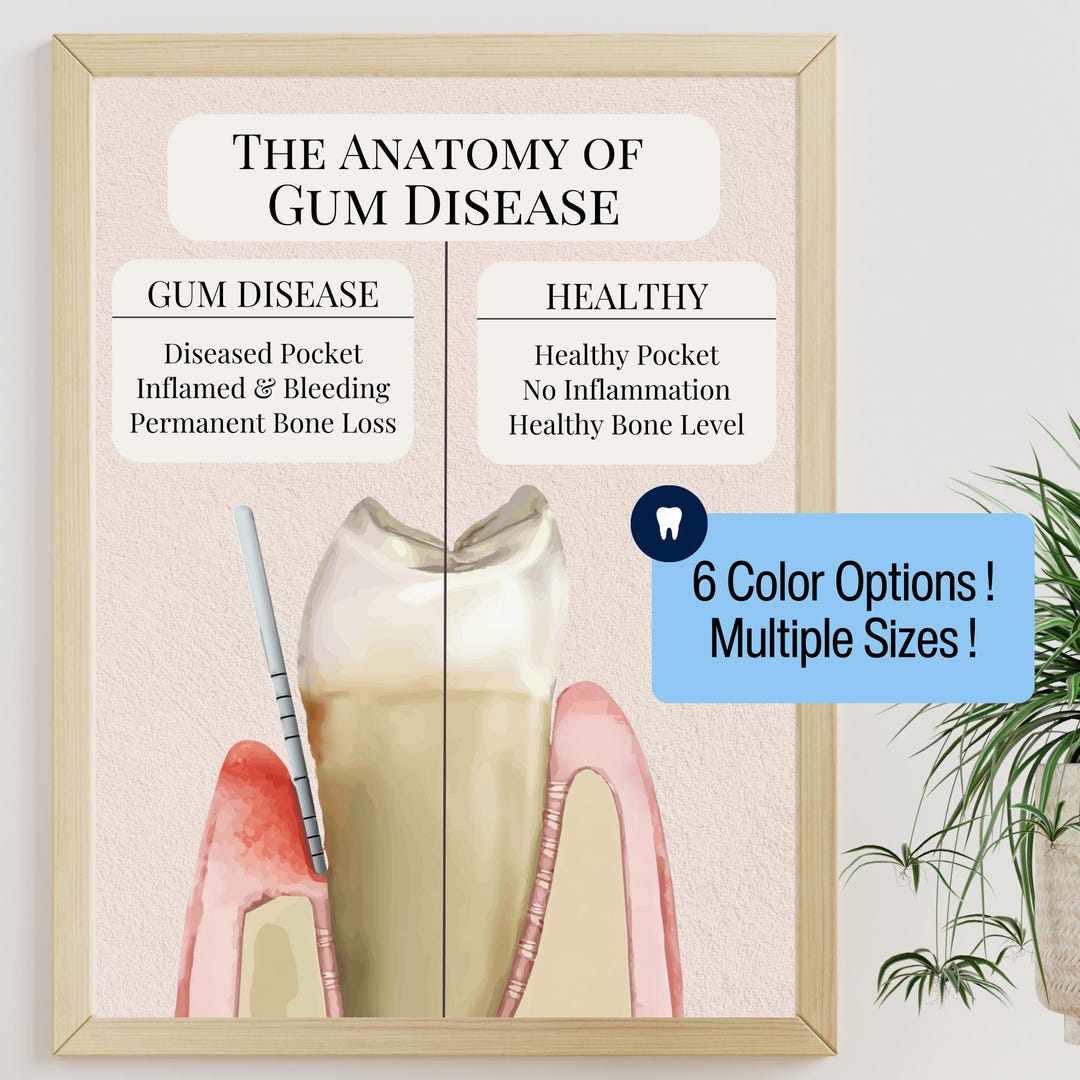 Dental Art Dental Office Decor for Periodontist Dental Print Dental ...