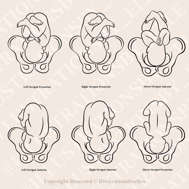 Fetal Positions SVG Line Art | Baby Birth Positions Line Drawing ...