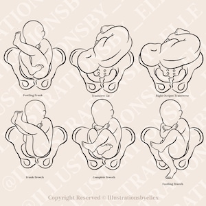 Fetal Positions SVG Line Art | Baby Birth Positions Line Drawing ...