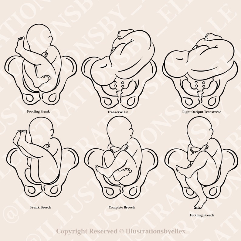 Fetal Positions SVG Line Art | Baby Birth Positions Line Drawing ...