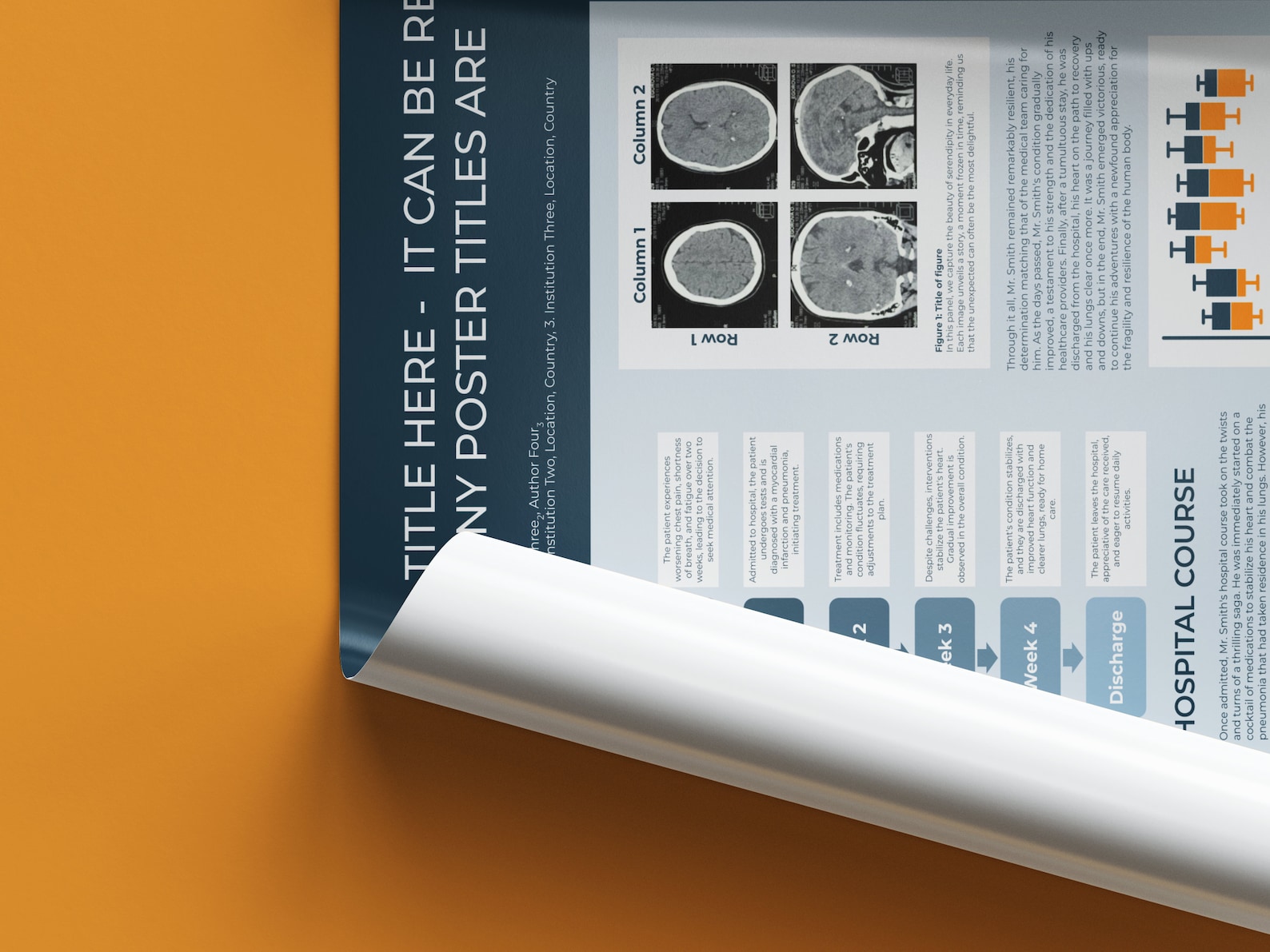 Scientific Poster Template and Medical Case Study Template for ...