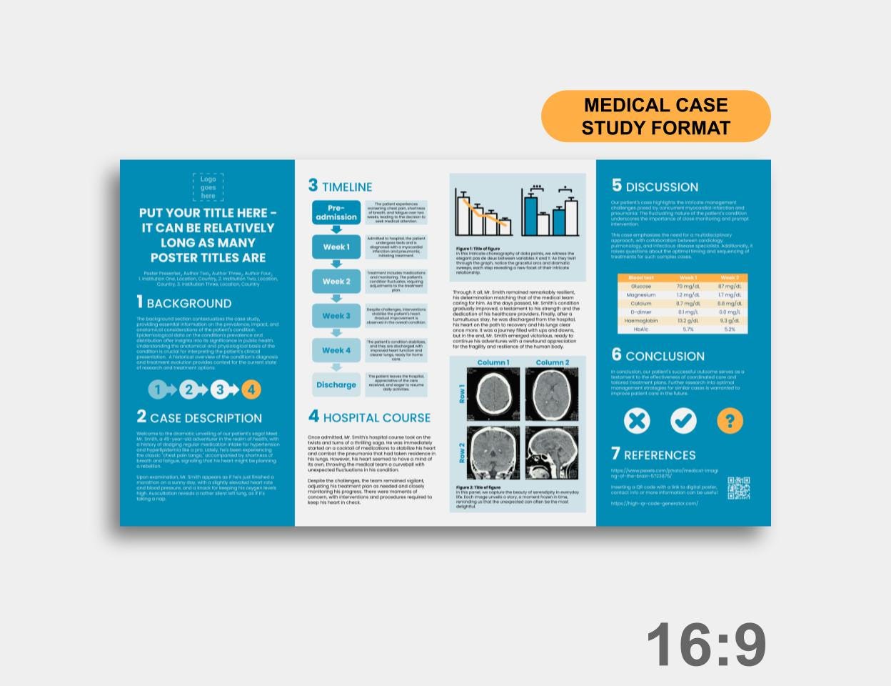 Scientific Poster Template Medical Case Study Template for Powerpoint ...