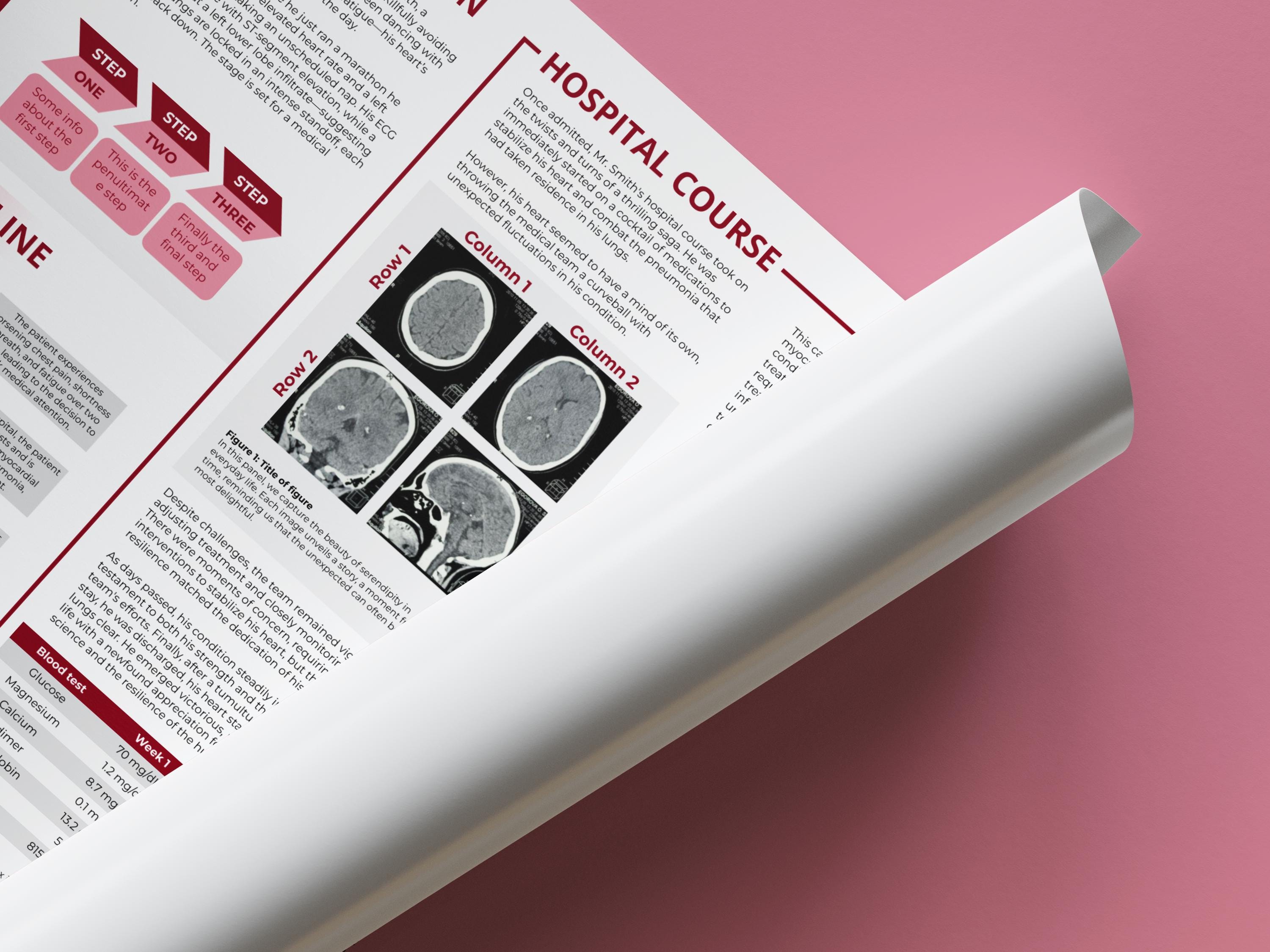 Scientific Poster Template Medical Case Study Powerpoint Google Slides ...