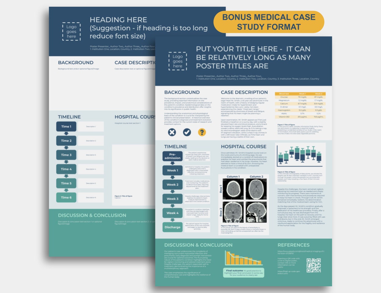 Scientific Poster Template Set - Powerpoint - Google Slides - DIGITAL ...
