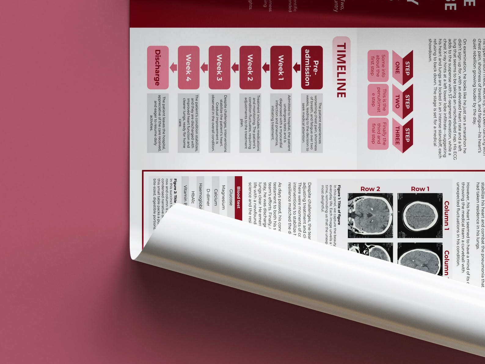Scientific Poster Template Medical Case Study Powerpoint Google Slides ...