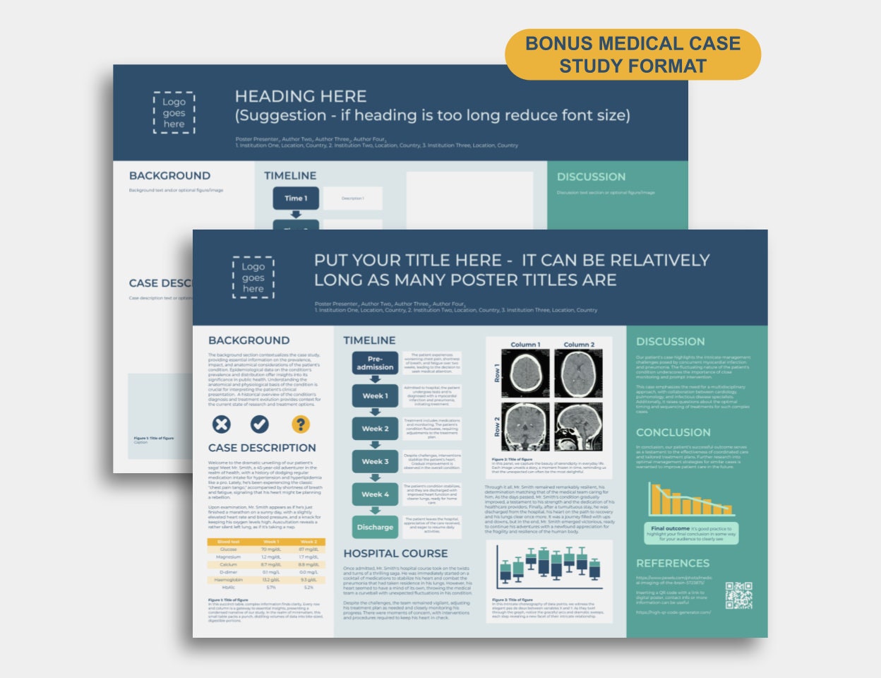 Scientific Poster Template Set - Powerpoint - Google Slides - DIGITAL ...