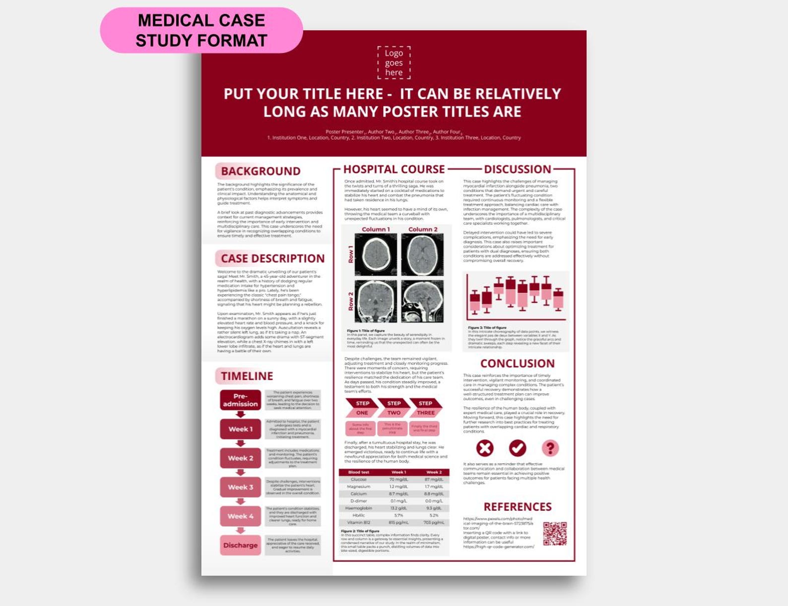 Scientific Poster Template Medical Case Study Powerpoint Google Slides ...