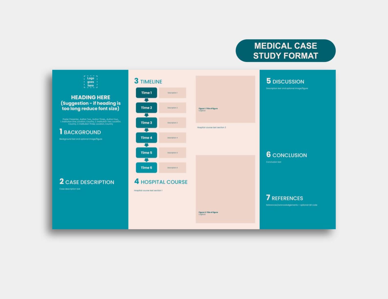 Scientific Poster Template Medical Case Study Template for Powerpoint ...