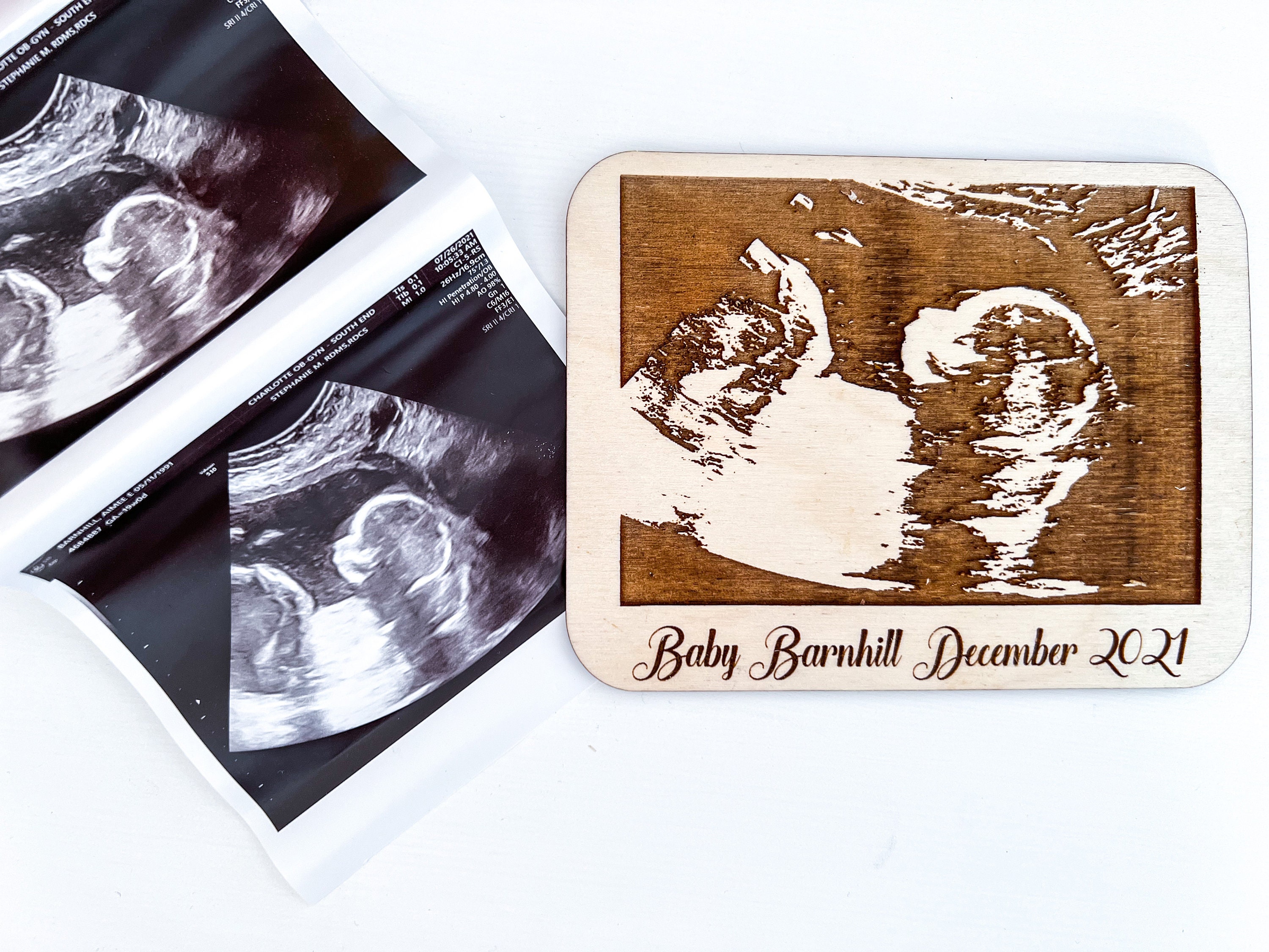 Sonogram Keepsake Baby Ultrasound Pregnancy Announcement - Etsy
