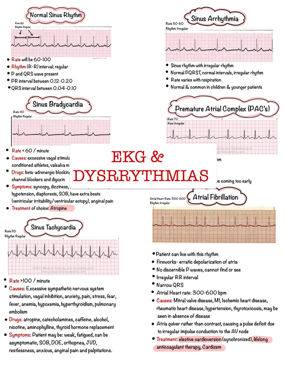 Basic EKG Dysrhythmias & Interpretation | Nursing Notes 6 PAGES ...