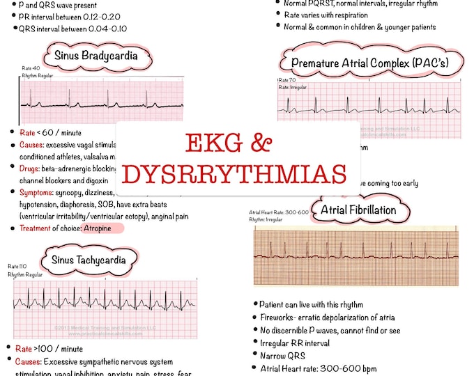 Basic EKG Dysrhythmias & Interpretation | Nursing Notes 6 PAGES ...