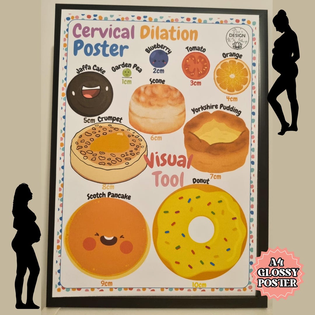 CERVICAL DILATION POSTER: Visual Study Room Tool, Midwifery Student ...