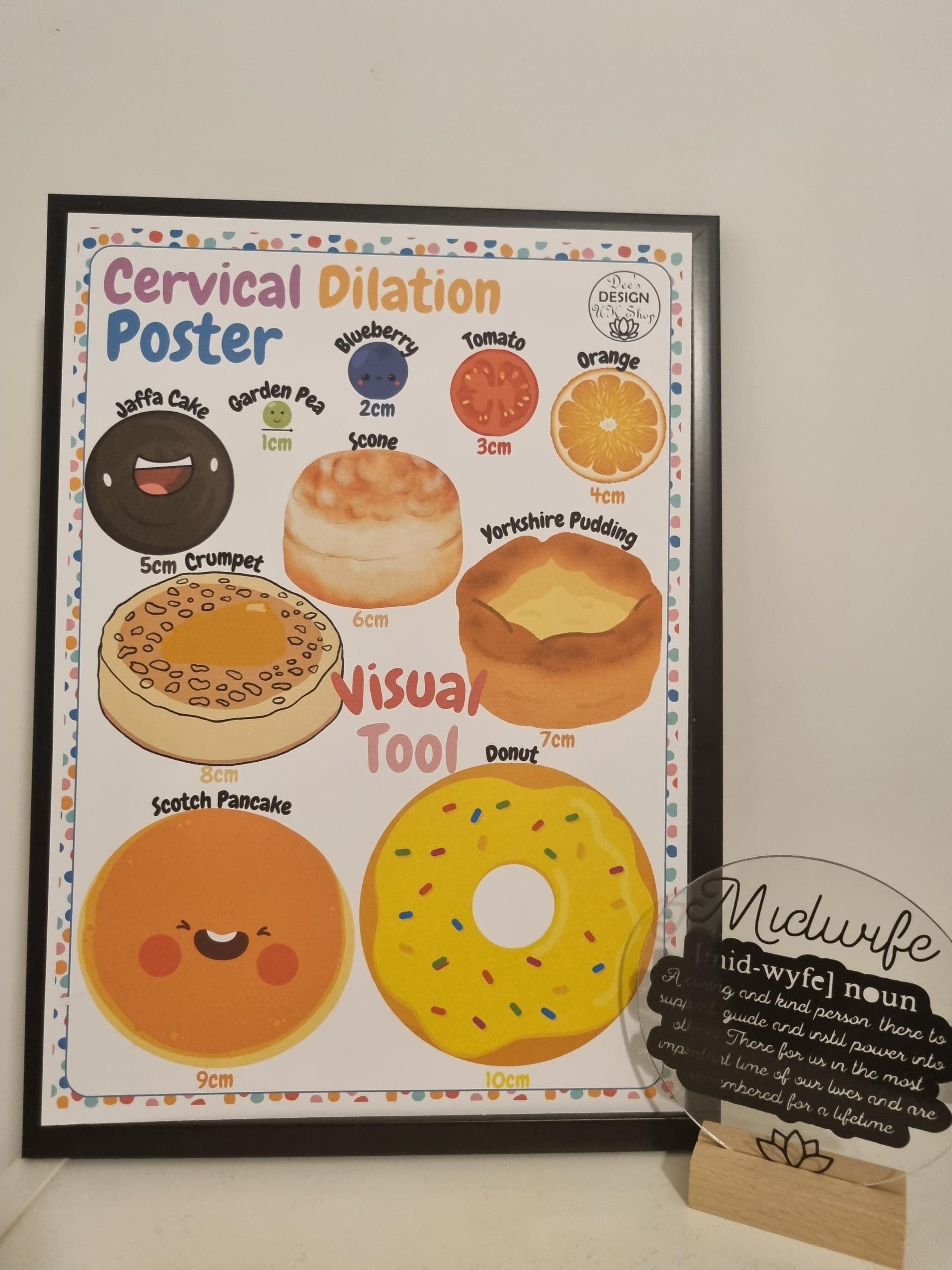 CERVICAL DILATION POSTER: Visual Study Room Tool, Midwifery Student ...