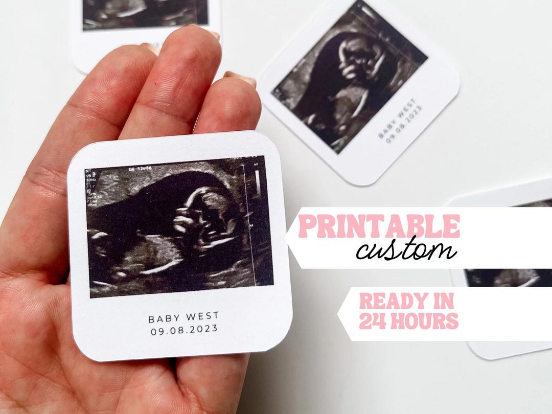 DIY Ultrasound Confetti | Downloadable Baby Shower Decorations | Custom ...