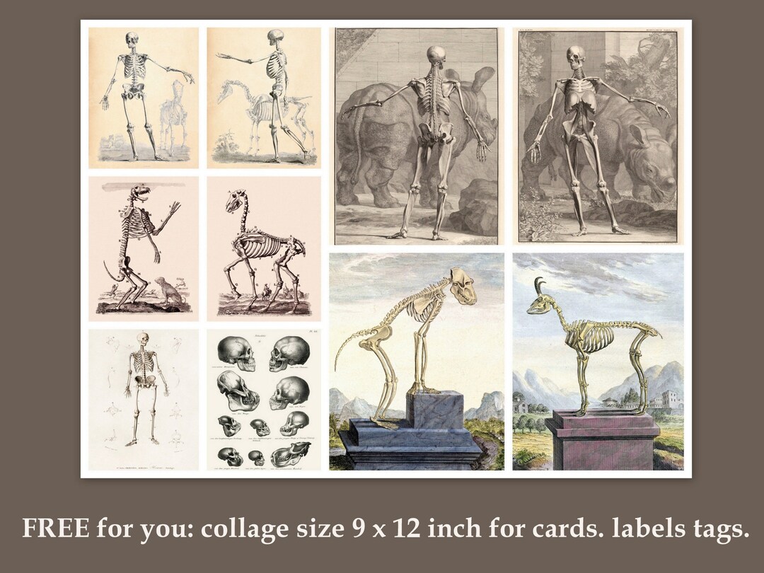 Gothic Printable Wall Collage Kit, Human Anatomy Illustration, Goth ...