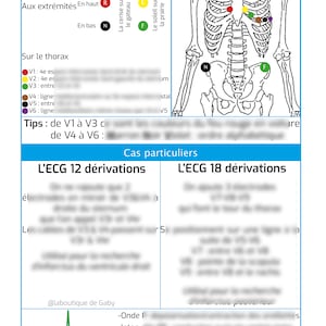 Fiche mémo ECG pour infirmière - Etsy France